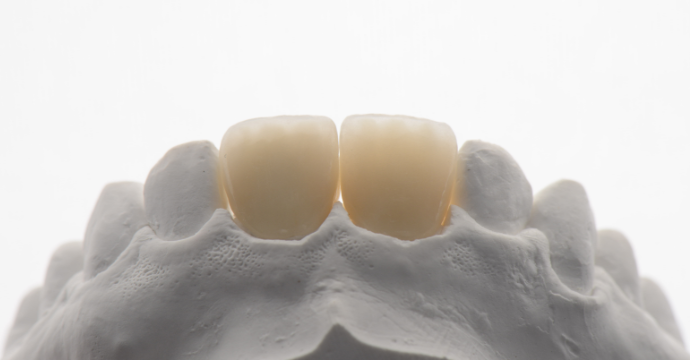 TRANSLUCENT TEETH: SYMPTOMS, CAUSES, TREATMENT – Fairywill